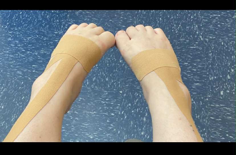 April Timmons témoigne de sa vie avec la maladie de Charcot-Marie-Tooth